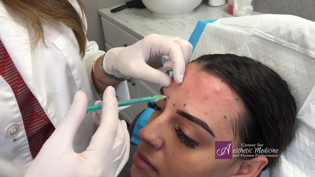 Watch Heather Rohrer, PA-C uses Botox to treat migraine headache - YouTube