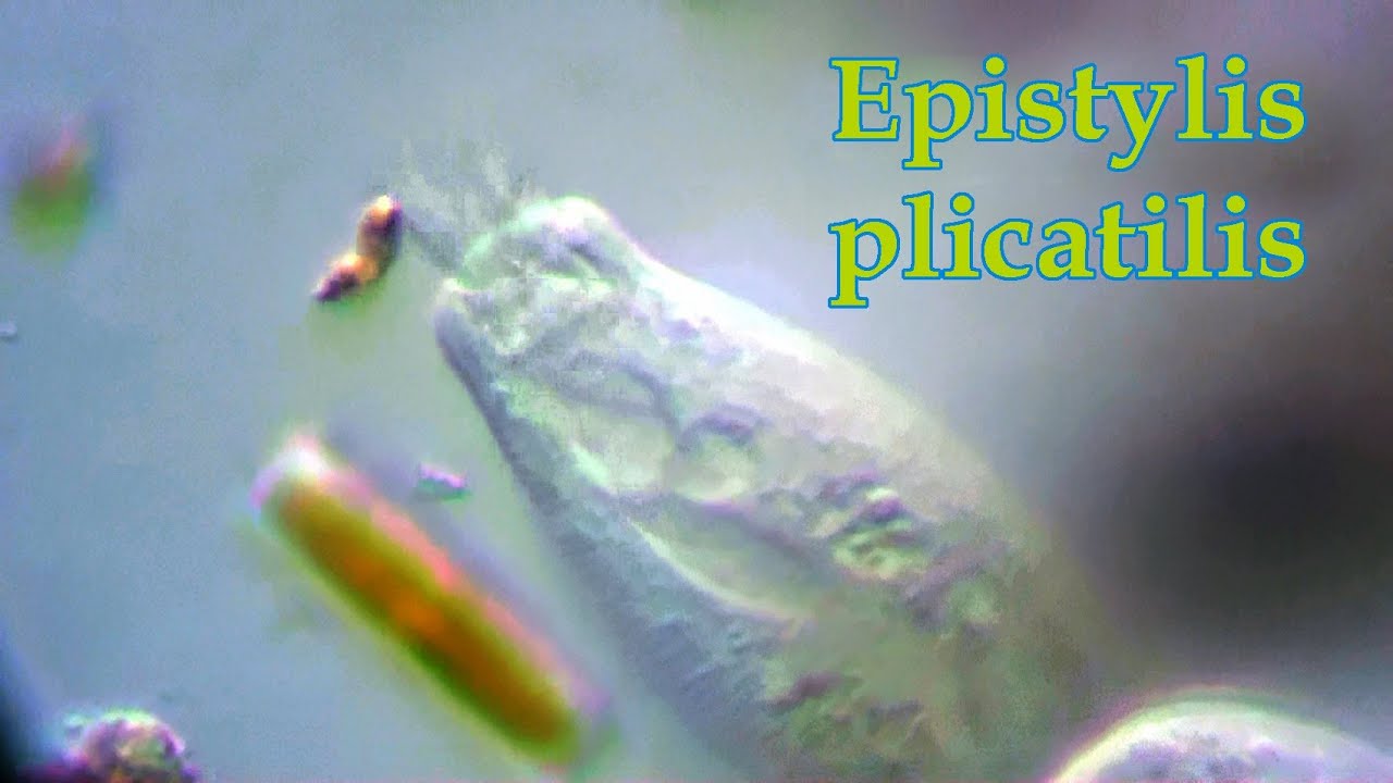 Epistylis plicatilis - YouTube