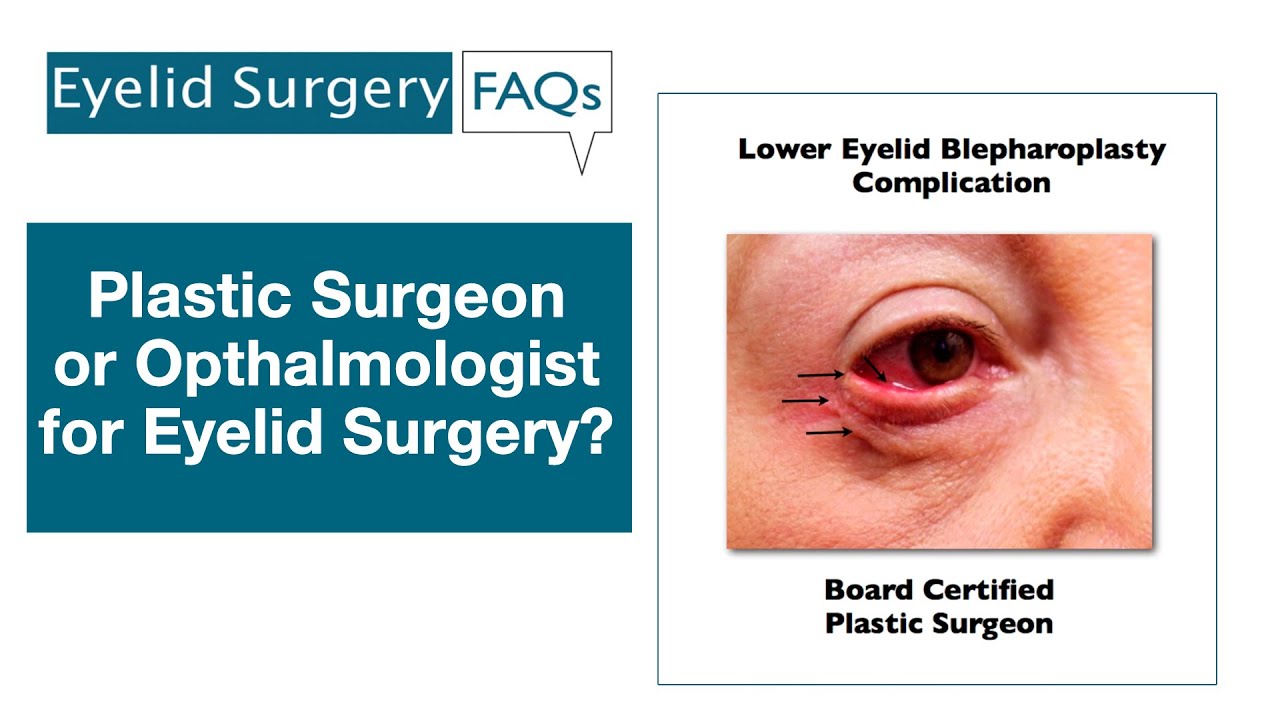 Plastic Surgeon, Ophthalmologist, or Eyelid Specialist for Eyelid ...