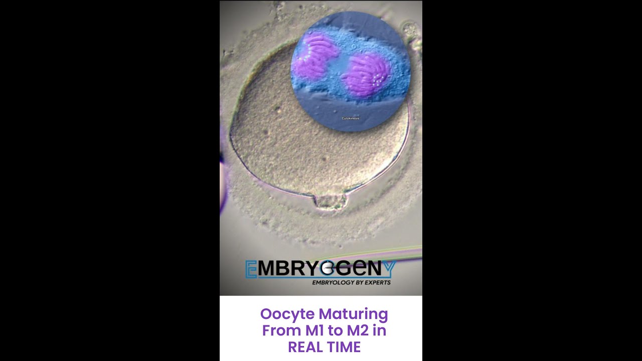 Oocyte Maturation from M1 to M2 in Real Time - Watch the Molecular ...
