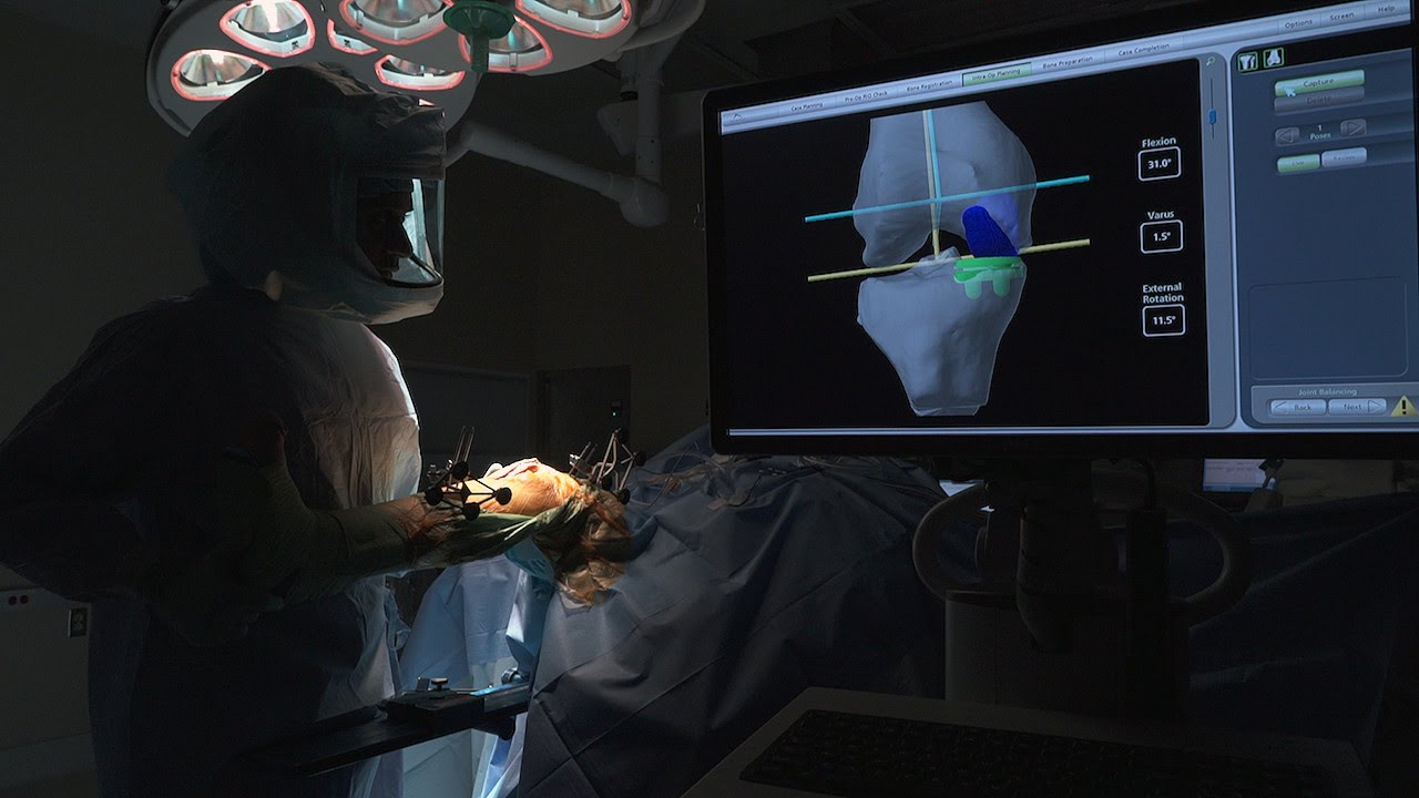 MAKOplasty Robotic-Arm Assisted Joint Replacement Surgery - YouTube