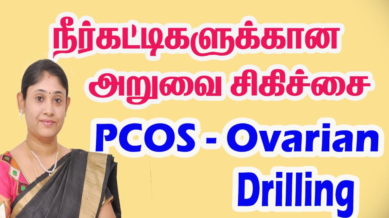 PCOS நீர்கட்டிகளுக்கான அறுவைசிகிச்சை PCOS Ovarian Drilling How To Get ...