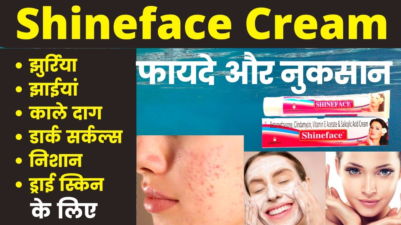 Shineface Cream | Shine face Cream |Shineface Cream side effects ...