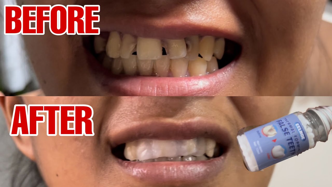 DIY FALSE TEETH BINILI NAMIN SA LAZADA - YouTube