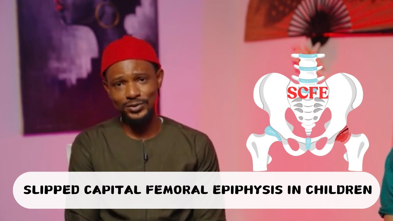 ALL YOU NEED TO KNOW ABOUT SCFE- SLIPPED CAPITAL FEMORAL EPIPHYSIS IN ...