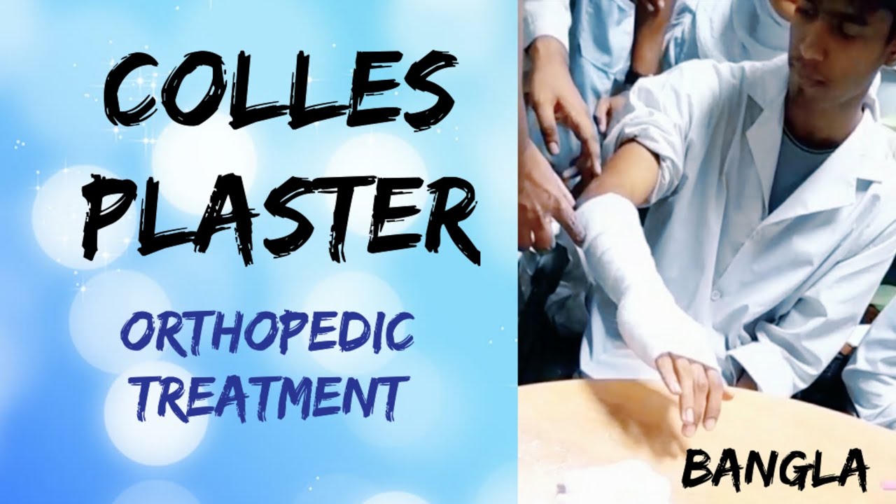 Orthopedic colles plaster treatment.Mbbs,Marmc.Bangla#mbbs #doctor ...