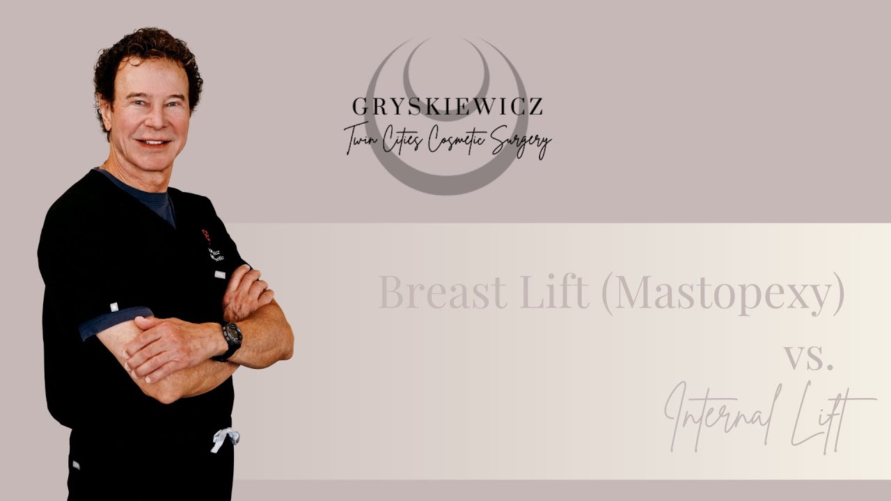 External Breast Lift vs. Internal Breast Lift with Dr. Joe Gryskiewicz ...