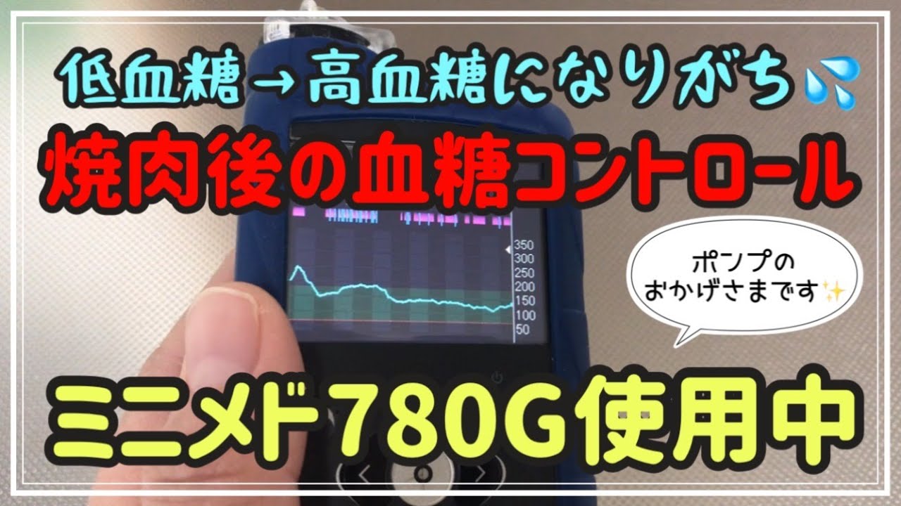 【1型糖尿病】焼肉後の血糖値をインスリンポンプに任せてみた！ ミニメド780G - YouTube