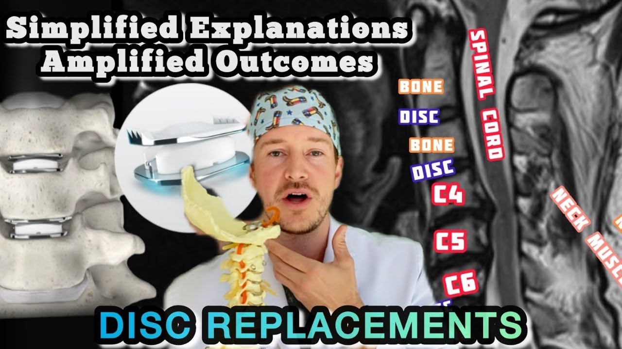 LIVE: Disc Replacements (Simplified Answers, Amplified Outcomes) - YouTube