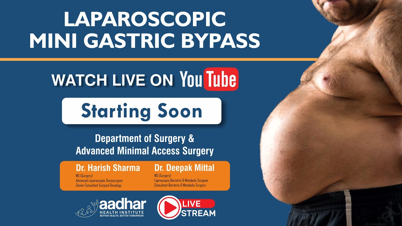 Laparoscopic Mini Gastric Bypass for Morbid Obesity (Weight Loss ...