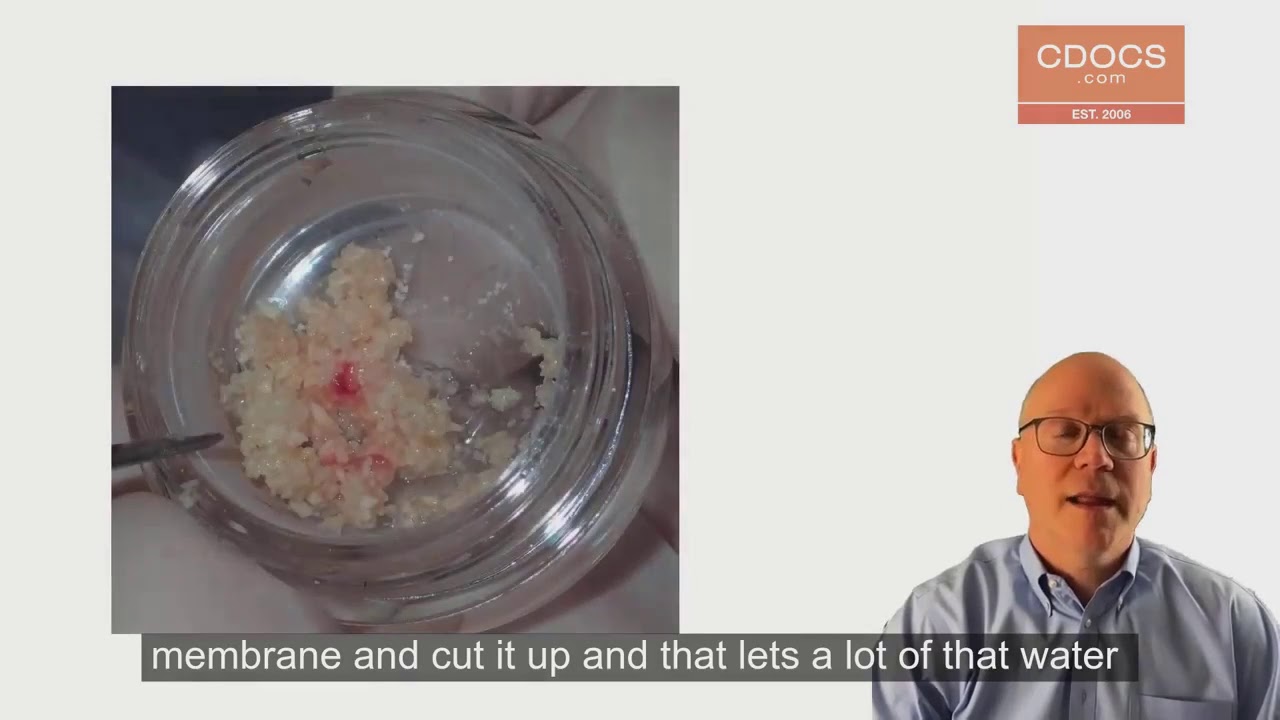 Tip of the Day: PRF Tips - YouTube