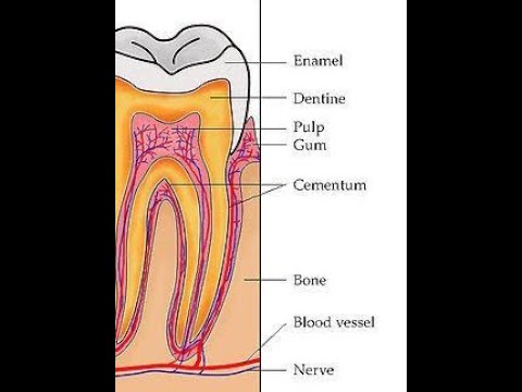 Pulpitis won't get better on its own / development of pulpitis can ...