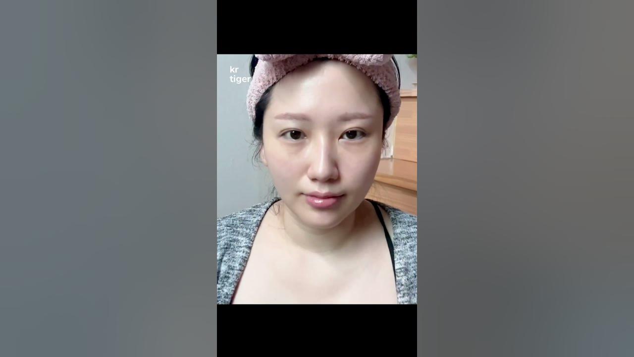 80만뷰 38세 처진 팔자주름과 광대 근막 리프팅 Self Massage 괄사마사지 Youtube