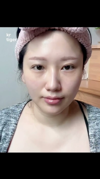 80만뷰 38세 처진 팔자주름과 광대 근막 리프팅 Self Massage 괄사마사지 Youtube