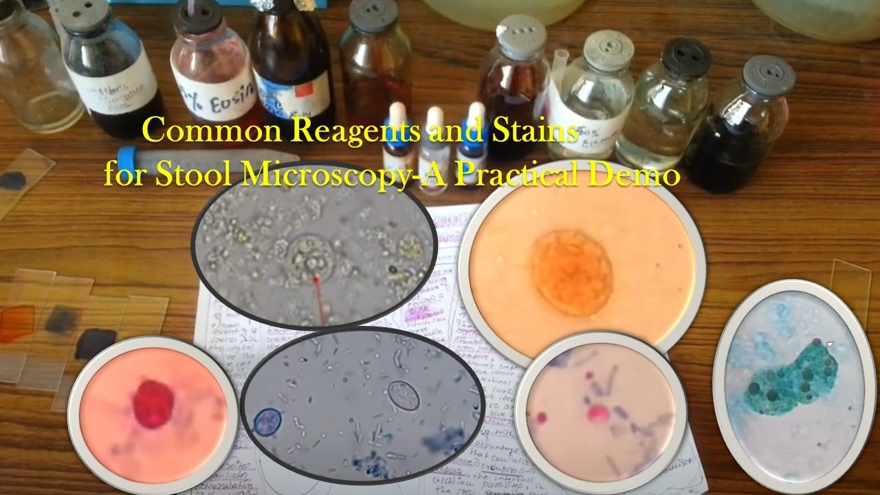 Common Reagents and Stains for Stool Microscopy-A Practical Demo - YouTube