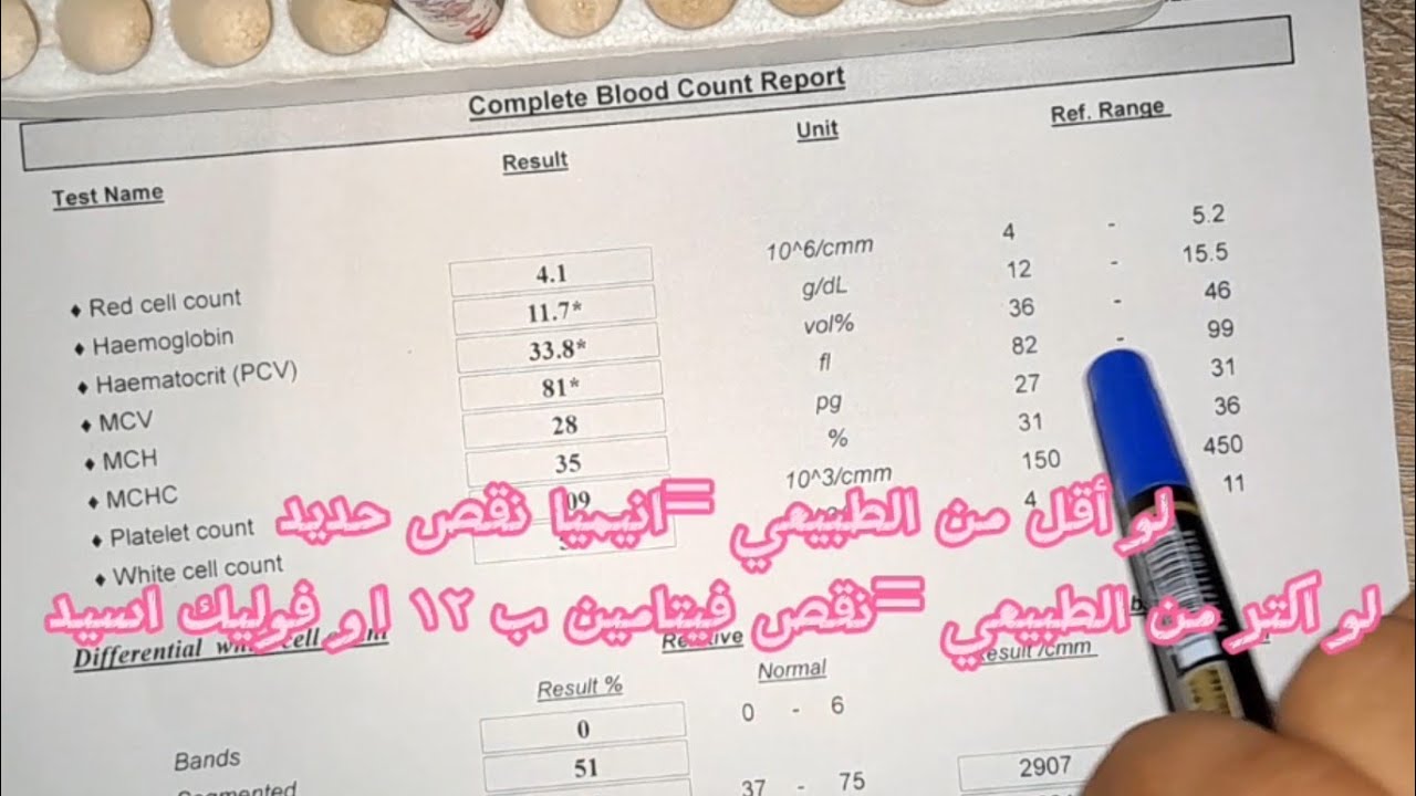 قراءة تحليل صورة الدم الكاملة(CBC) - YouTube
