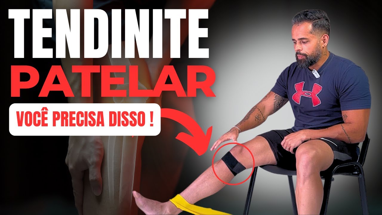 🚨[INÉDITO]🚨TRATANDO TENDINITE PATELAR: O QUE NINGUÉM TE ENSINOU! - YouTube