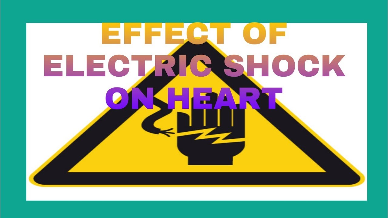 effect of electric shock on heart/defibrillator/fibrillation - YouTube
