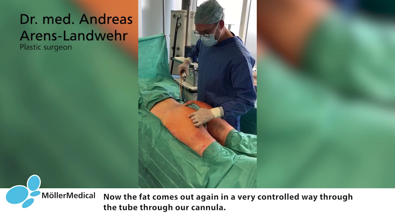 Working with Möller Medical´s Aesthetics Solutions - YouTube