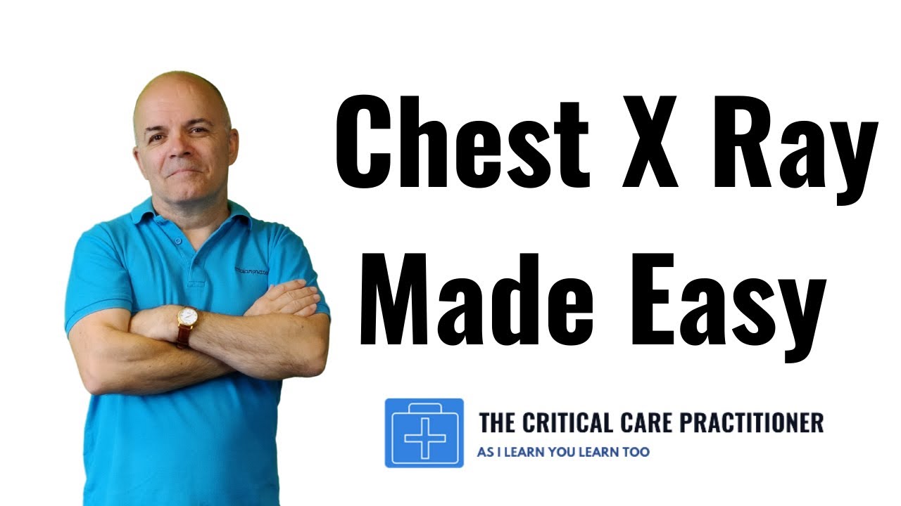 An EASY way to read the Chest X Ray! - YouTube