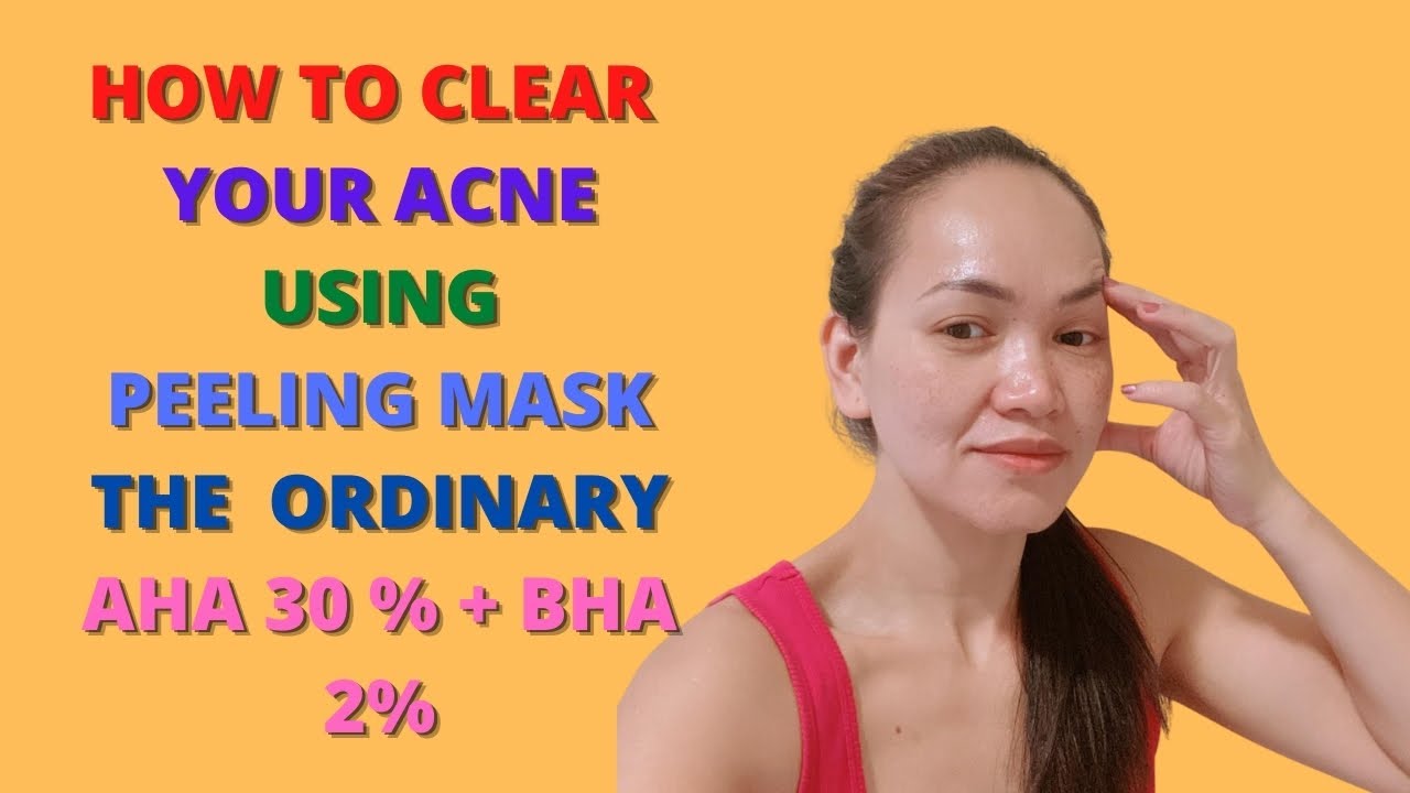 HOW TO CLEAR YOUR ACNE PEELING MASK YOU NEED| THE Ordinary product. AHA ...