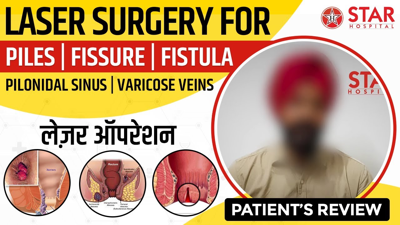 Best Fistula Hospital In Ludhiana | Laser Treatment in Ludhiana ...
