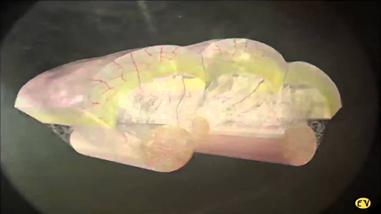 Fluid Tissue - Strolling under the Skin - Fascia - YouTube