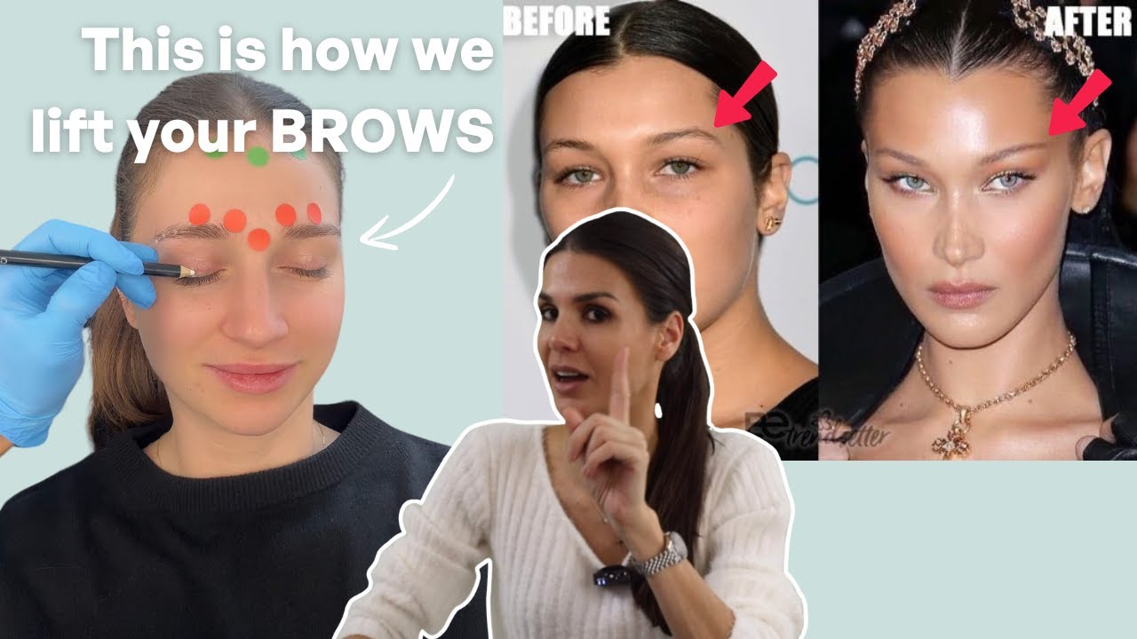 Botox BROW lift for HOODED eyes - YouTube