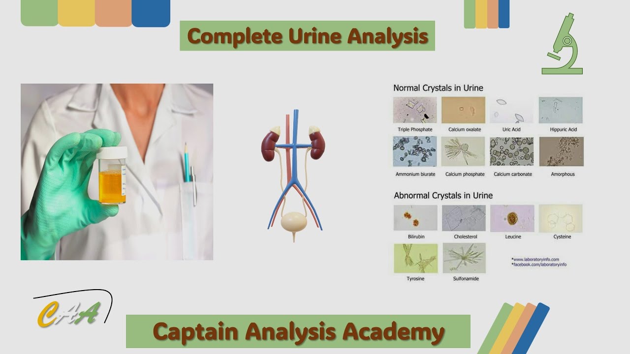 Complete Urine Analysis تحليل البول الكامل - YouTube