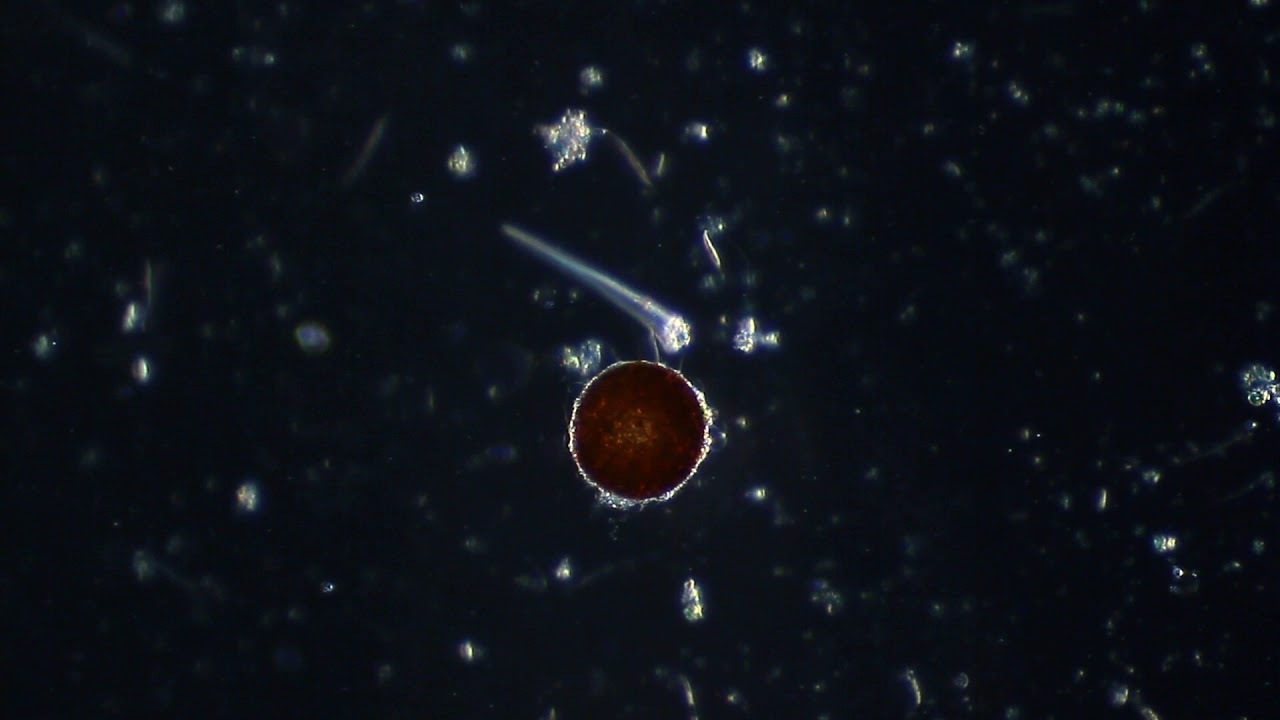 Arcella sp. (Testate amoeba) - Protozoans and other small critters ...