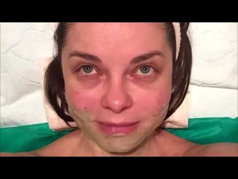 Взгляните на фото без макияжа! Наташа Королева без фотошопа