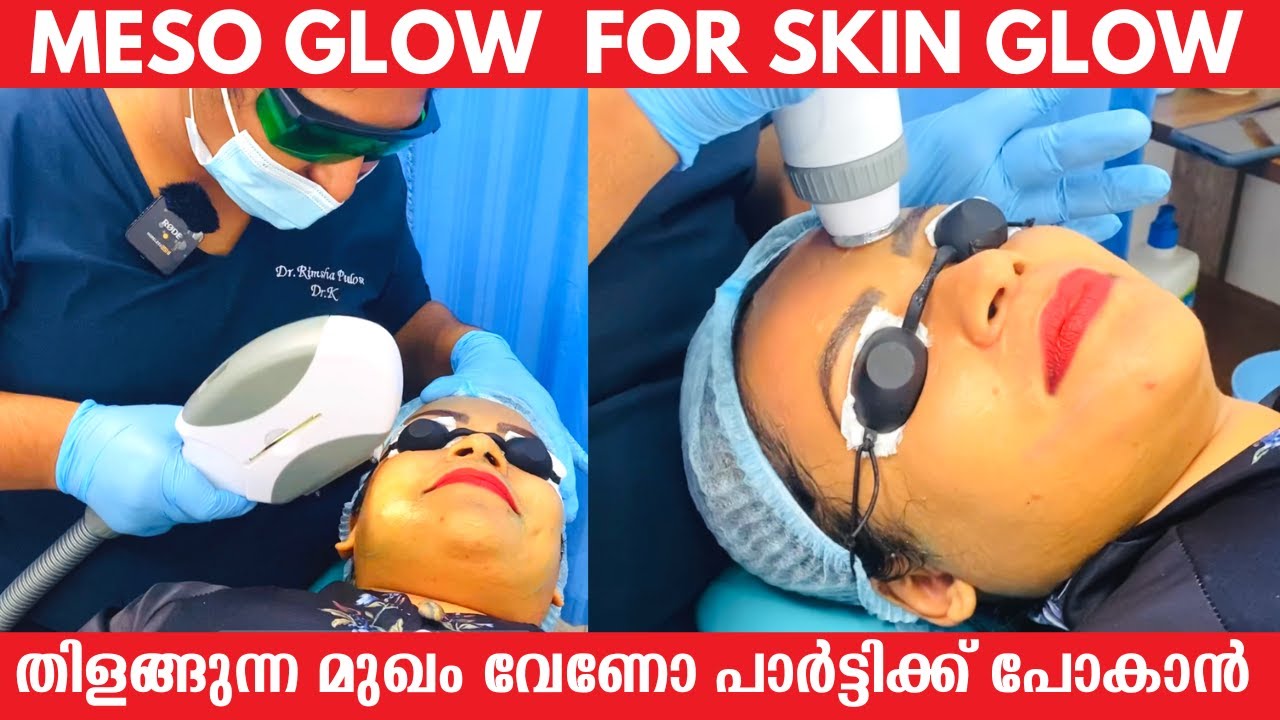 🌺 തിളങ്ങുന്ന മുഖം വേണോ 💕 പാർട്ടിക്ക് പോകാൻ Meso Glow Treatment For Skin ...