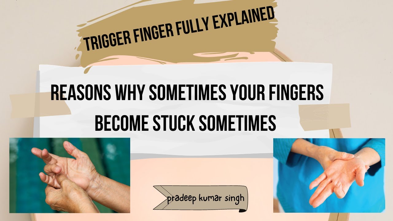 Why Do your Fingers become Stuck Sometimes /Trigger Finger Explained ...