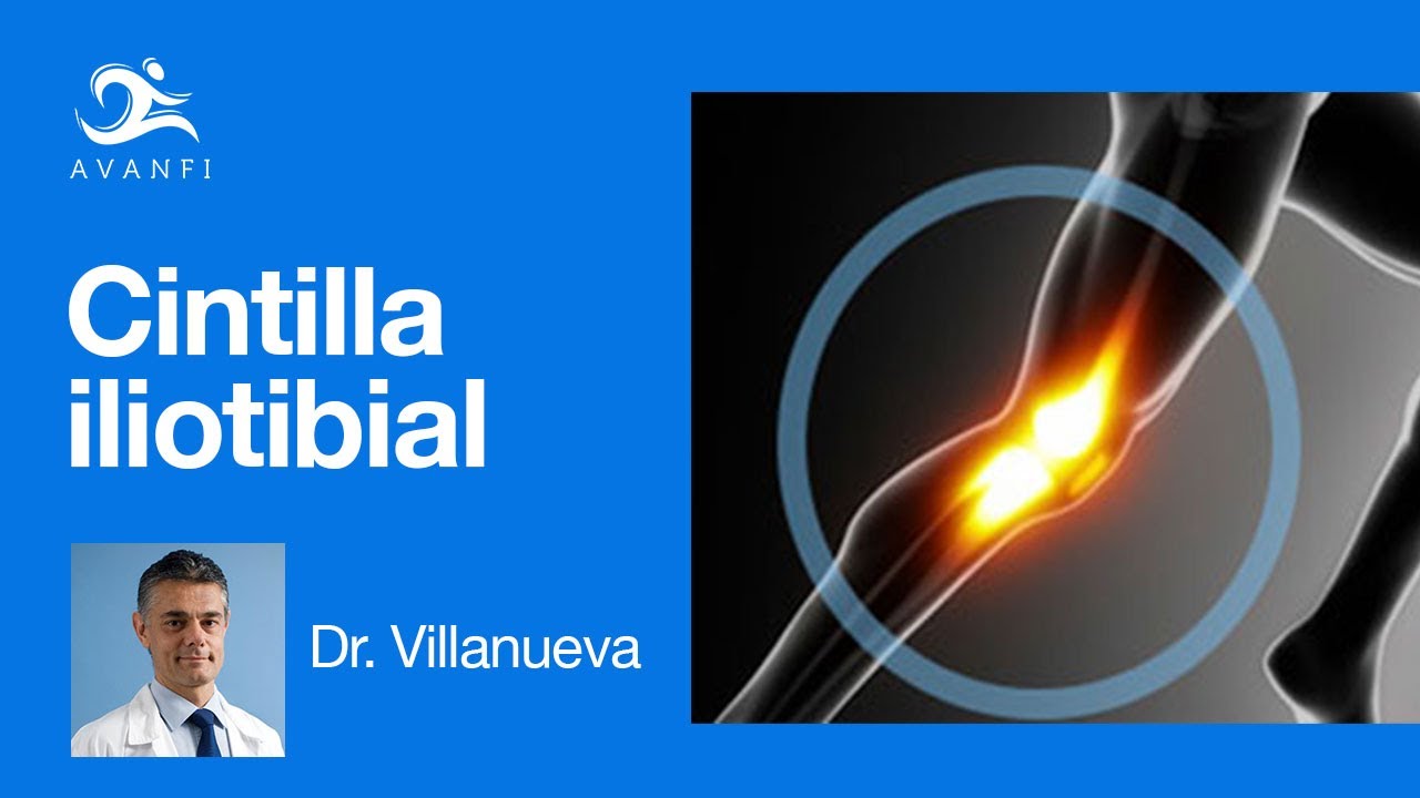 Síndrome de la Cintilla Iliotibial. Especialista en Rodilla Dr ...