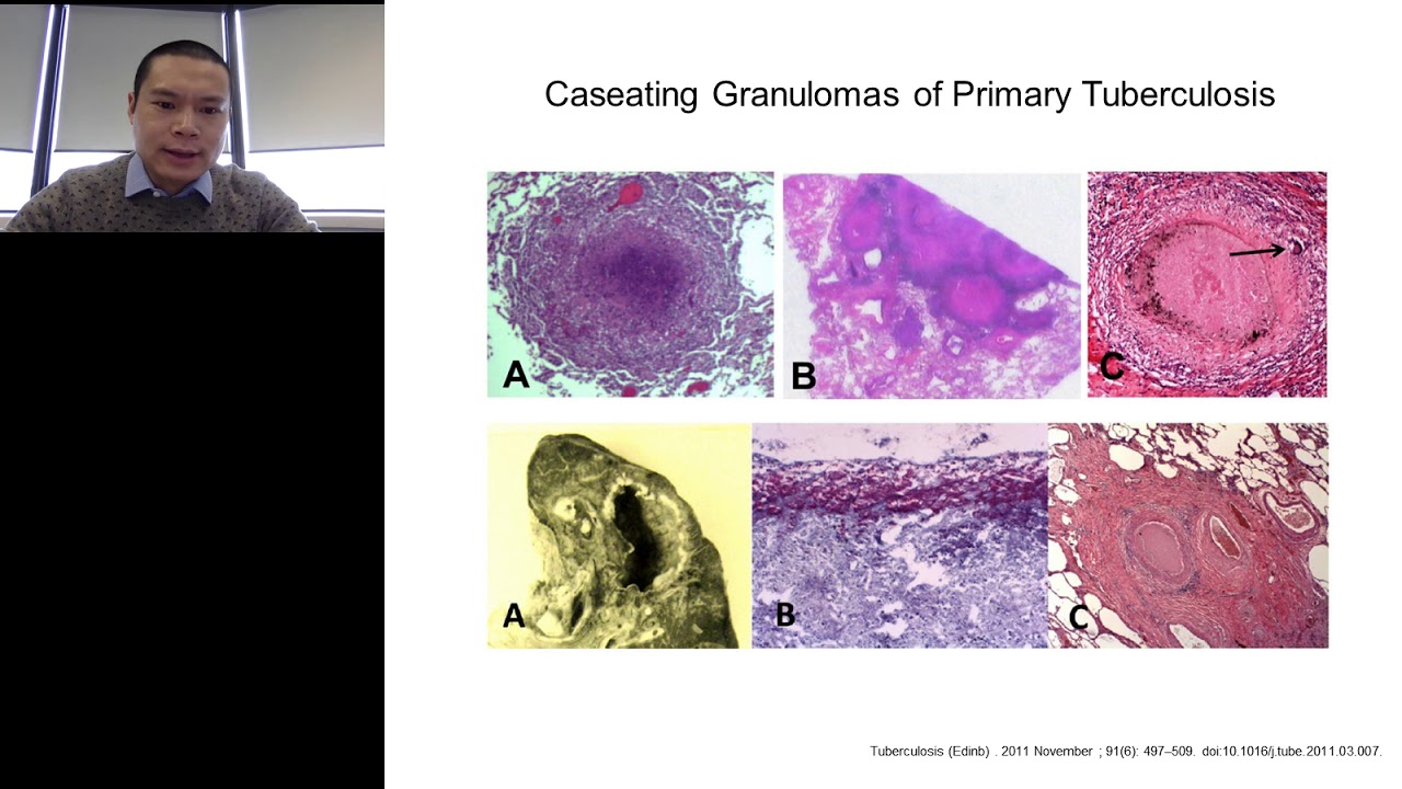 Animal Models for Tuberculosis Research - YouTube