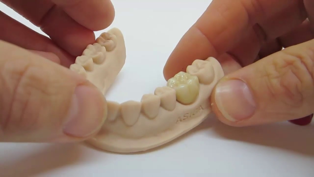 Asiga DentaMODEL for crown and bridge sgdentalshop.com - YouTube