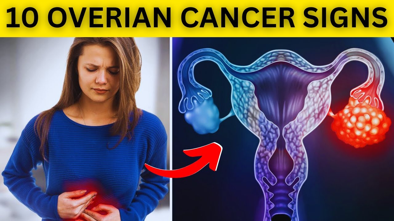 10 Common Ovarian Cancer Signs That You Should Never Ignore Youtube