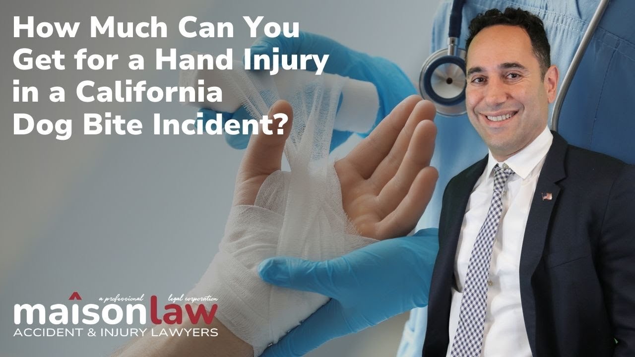 How Much Can You Get For a Hand Injury in a California Dog Bite ...