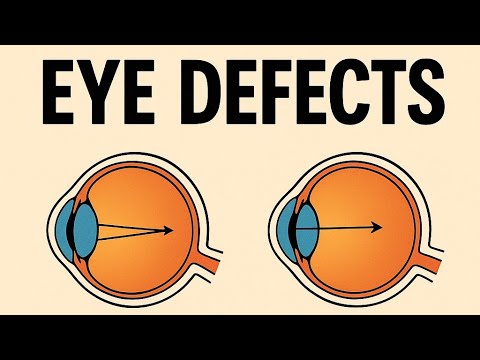 Eye defects and their Correction class 10 Science - YouTube