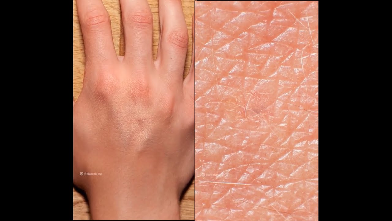 Hand's Skin Zoomed In (Way too much) - YouTube
