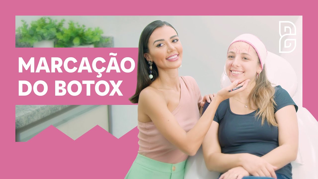 Marcação de Botox e os músculos da face! - YouTube