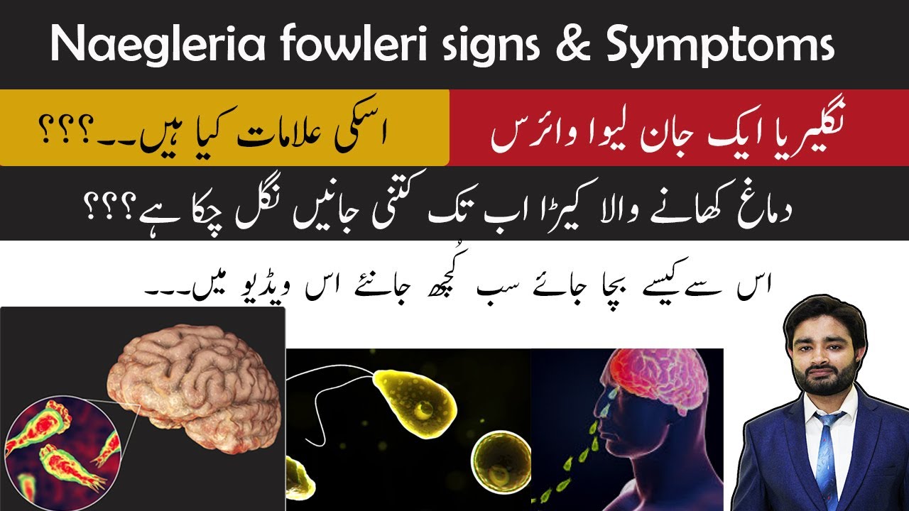 Naegleria Fowleri Amoeba | Brain eating virus | signs & symptoms ...
