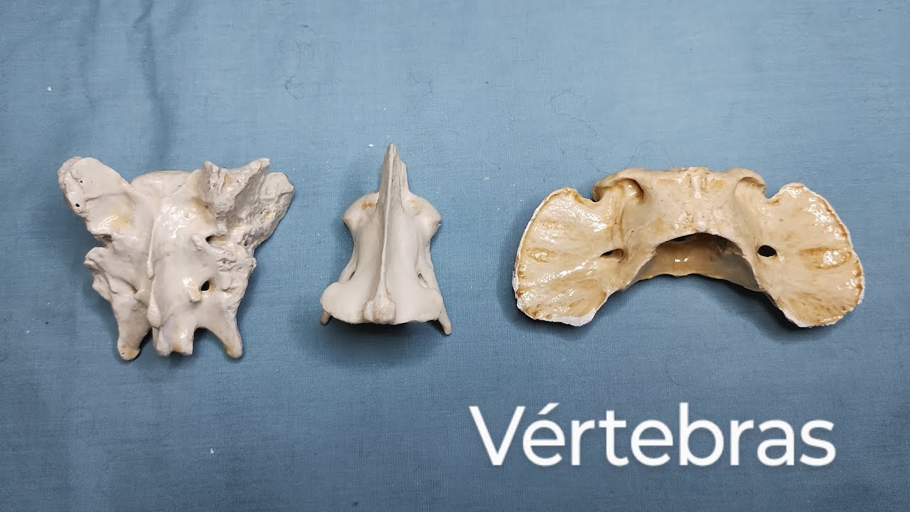 Anatomía de las vértebras. - YouTube