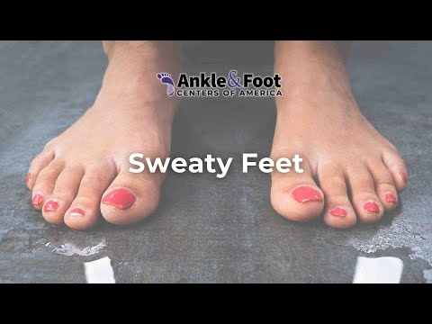 Sweaty Feet | Ankle & Foot Centers of America