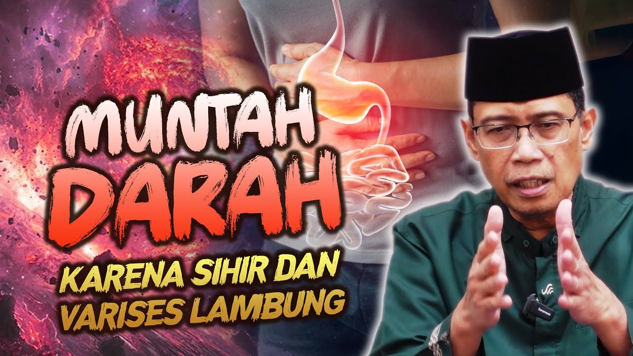 MUNTAH DARAH KARENA SIHIR DAN VARISES LAMBUNG - YouTube