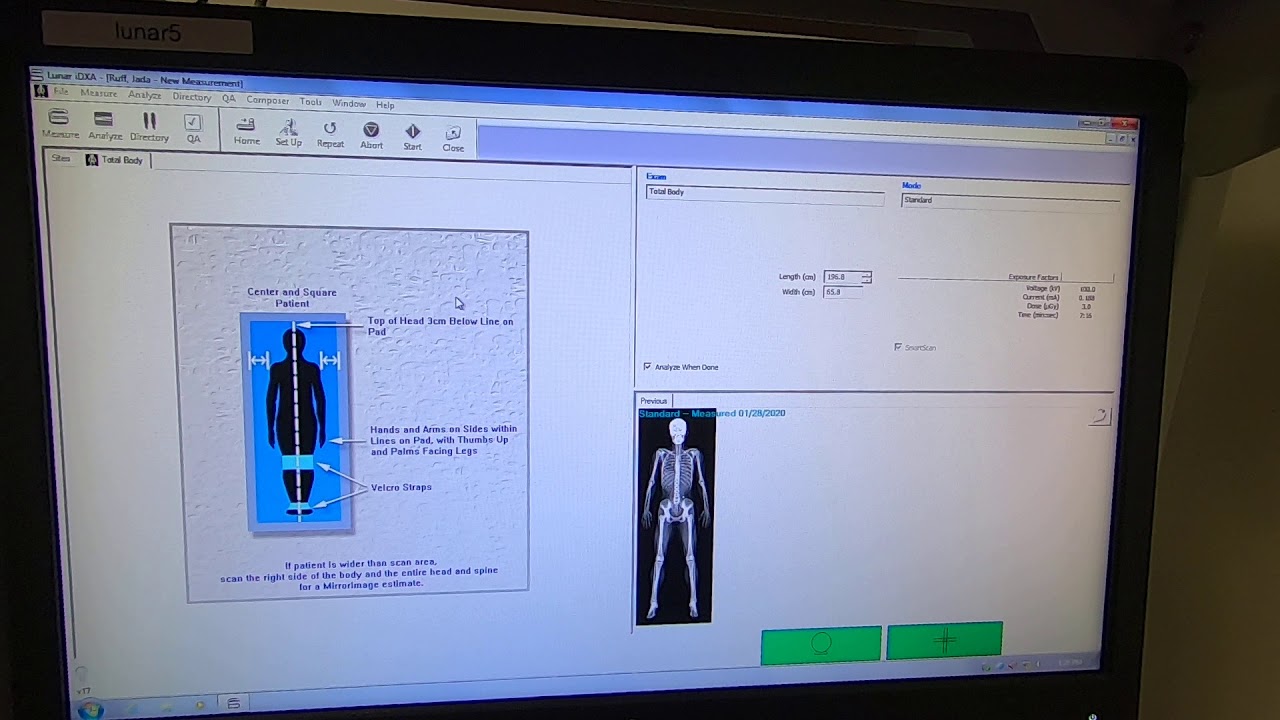 Start the test on iDXA - YouTube