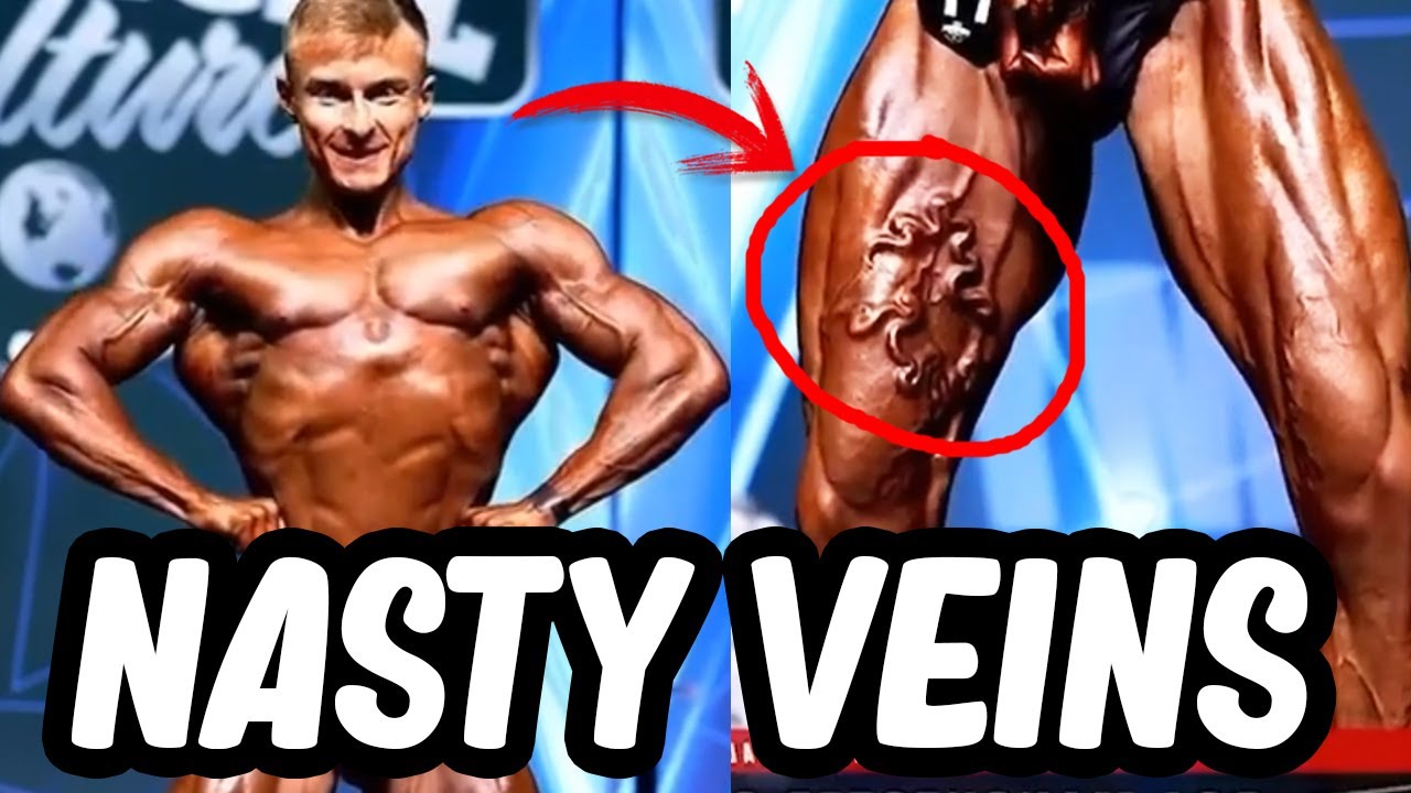 The Disgusting Side of Bodybuilding | Best gym and bodybuilding fails ...