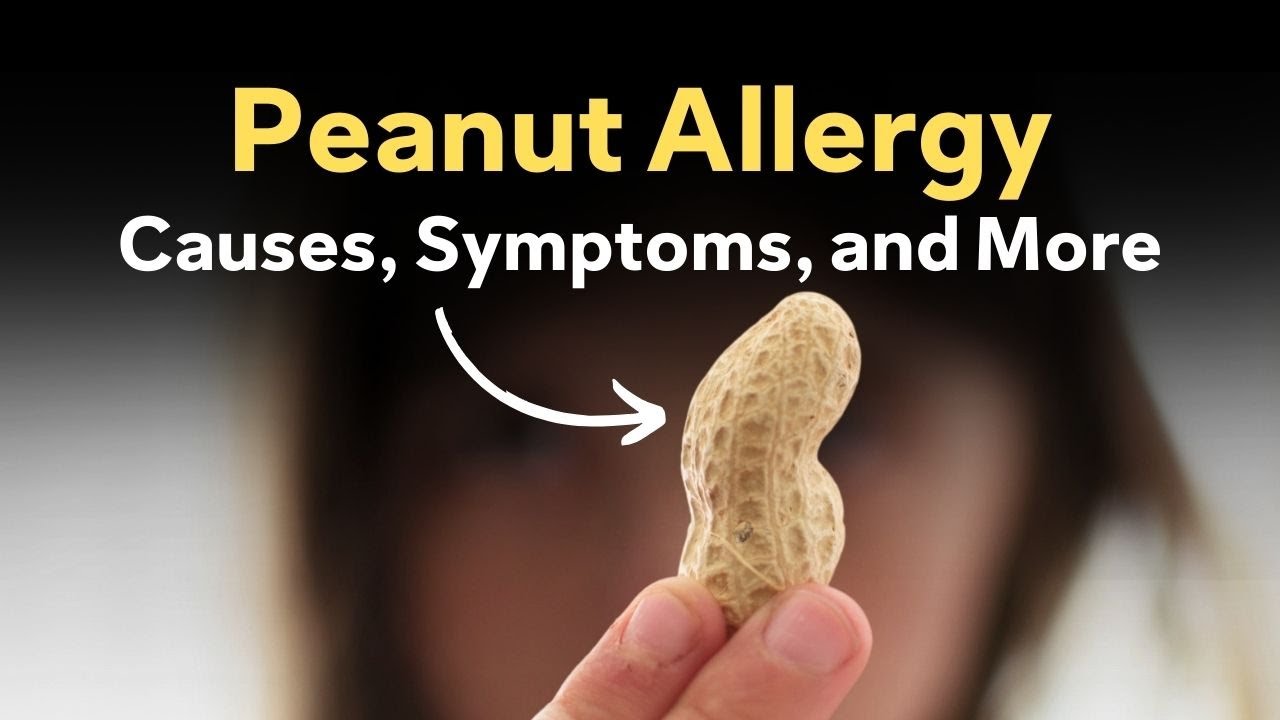 Peanut Allergy - Causes, Symptoms, Diagnosis Methods and More - YouTube