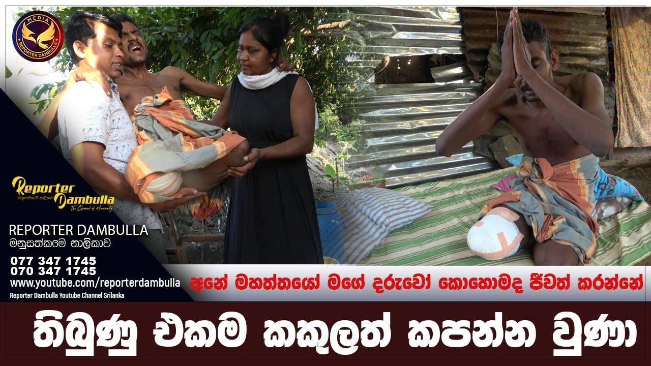 තිබුණු එකම කකුලත් කපන්න වුණා මං හරී පව් කාරයි || Reporter Dambulla ...