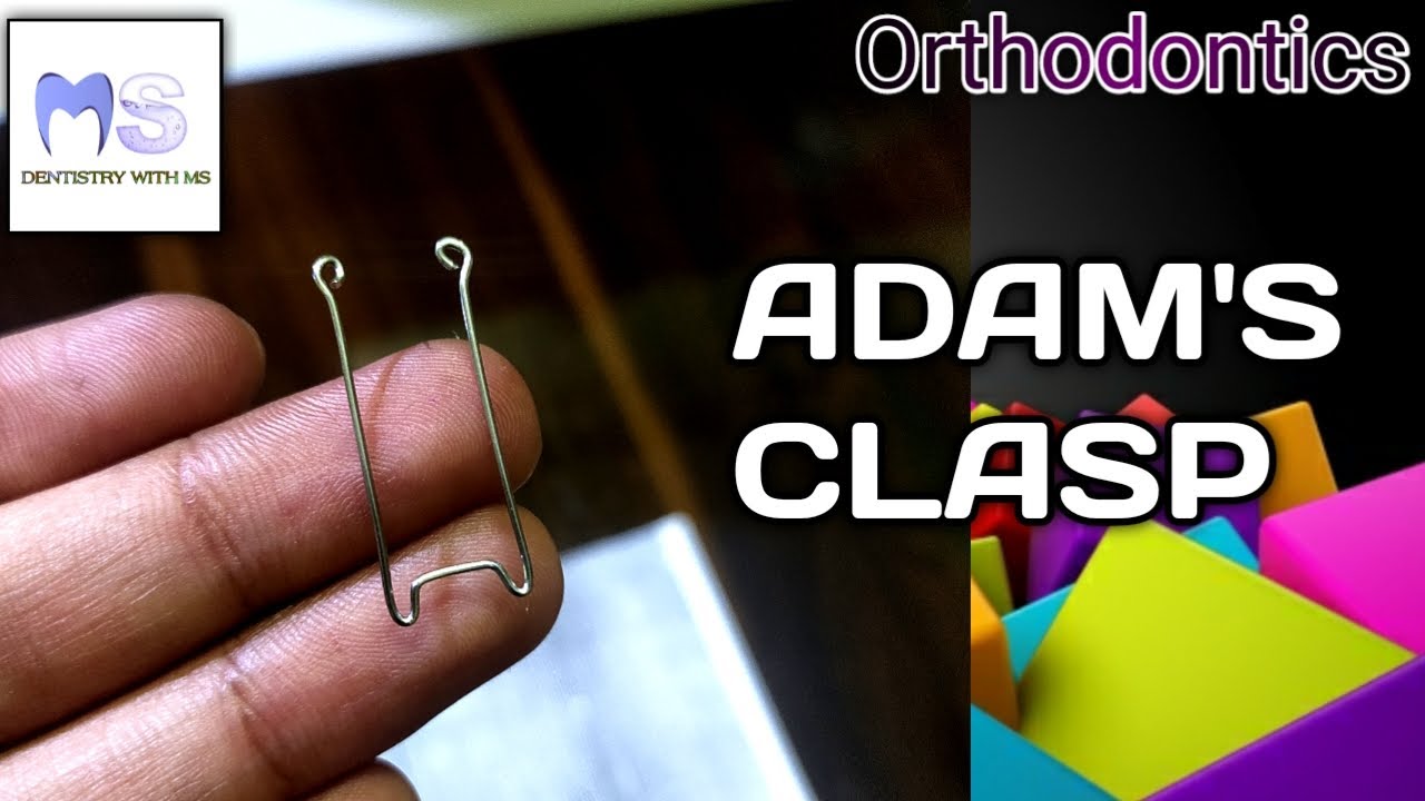 ADAM'S CLASP making (for 3rd yr bds on paper submission )| Orthodontic ...